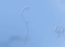 There appears to be shadows in my vision - What do I do?