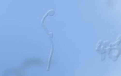 There appears to be shadows in my vision - What do I do?