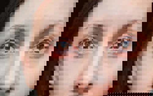 My eyelid turns outwards - Why are my eyelids turning outwards?